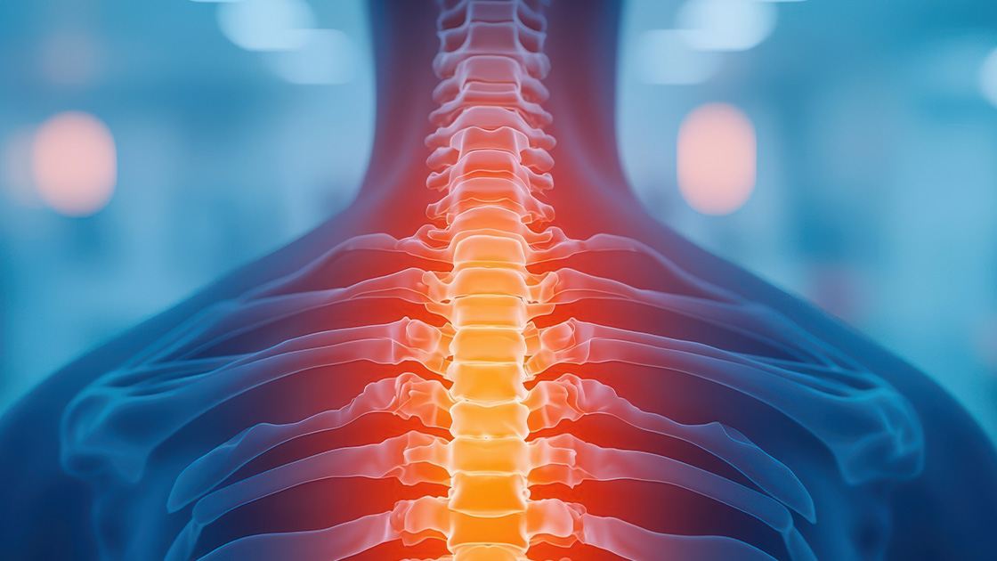 Discseel Procedure | Top Neurosurgeon