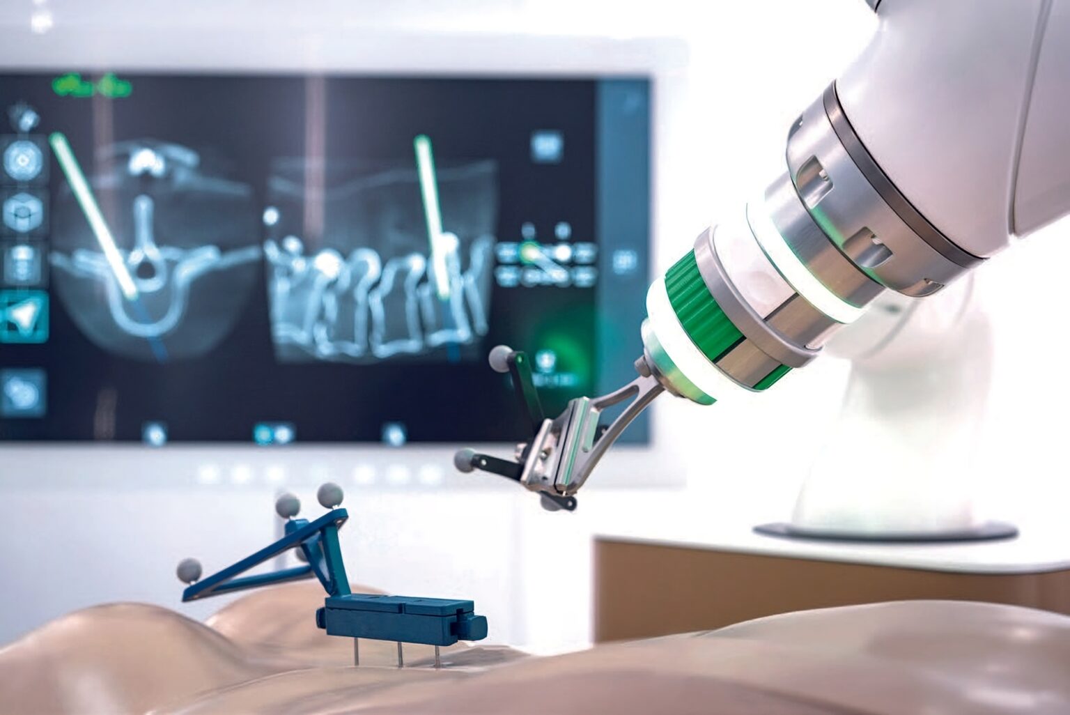 Robotic Spine Surgery - The Morrison Clinic